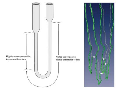 The Loop Of Henle Deranged Physiology