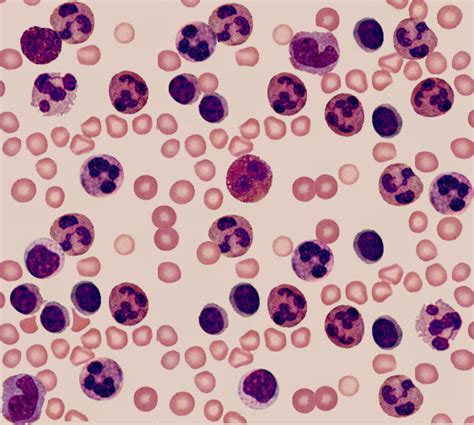 Differential Staining