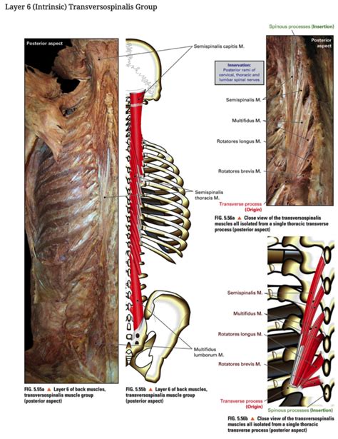 Transversospinalis Mm Diagram Quizlet