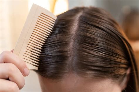 Scalp Anatomy Functions And Disorders Intakelearn