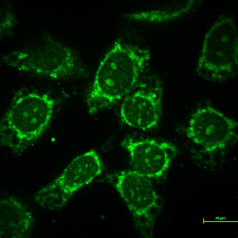 Why Am I Getting Localisation Of Nuclear Protein In Cytoplasm