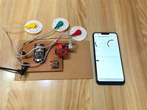 Iot Based Health Monitoring With Ecg Spo2 And Temperature Sr Robotics