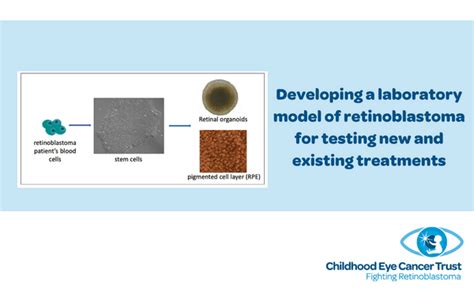 Developing A Laboratory Model Of Retinoblastoma For Testing New And Existing Treatments Dr A