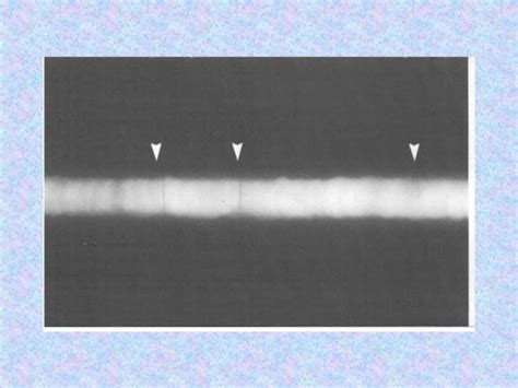 Types Of Radio Graphic Rt Weld Examination Defectsppt
