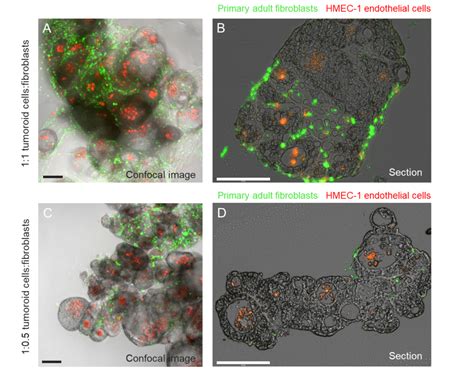 Co Culturing Patient Derived Cancer Organoids With Fibroblasts And Endothelial Cells Behind