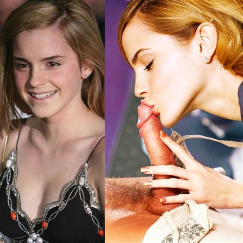 Before And After Emma Watson Porn Pictures Xxx Photos Sex Images