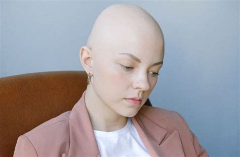 Kisah Nyata Rambut Botak Tumbuh Kembali Homecare24