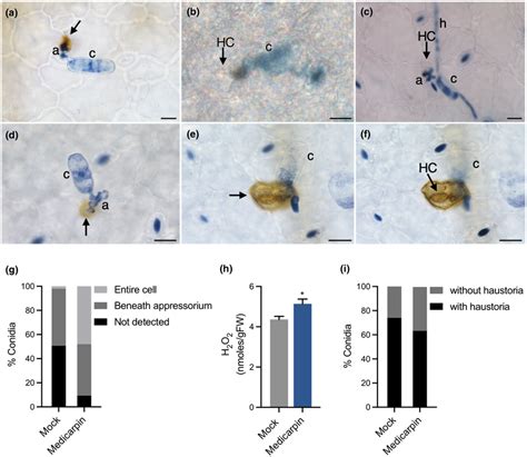 Detection Of H2O2 At Powdery Mildew PM Infection Sites After Download Scientific Diagram