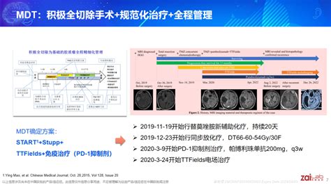 【说文解惑】2023aacr：肿瘤电场治疗联合tmz及免疫治疗在多不良预后因素阳性的gbm患者中显示出长pfs的一则病案报道 脑医汇 神外资讯 神介资讯