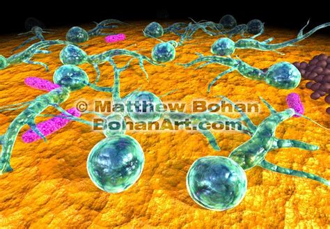 Medical Illustration And Animation Matthew Bohan Illustration Medical