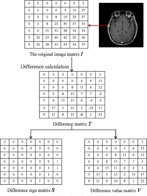 Figure 2 From Lossless Compression Of Medical Images Based On The