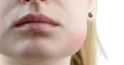 How To Reduce Swelling On Your Face Lymph Specialist Guide