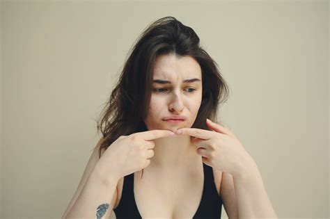 Dealing With Perimenopausal Acne Understanding Causes And Finding