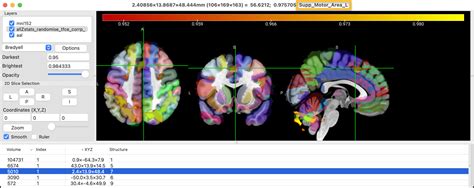 Image Visualization With Mricrogl — Andys Brain Book 1 0 Documentation