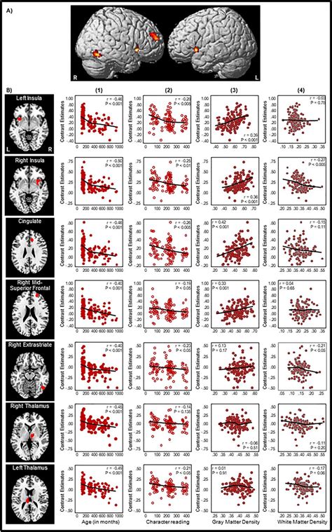 A Negative Correlations From The Whole Brain Regression Analysis With
