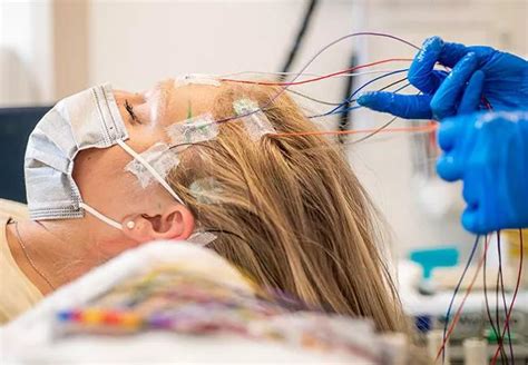 Predicting Seizure Control After Epilepsy Surgery