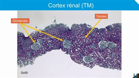 Mediapod Col Sciences De La Santé Introduction À La Nephropathologie