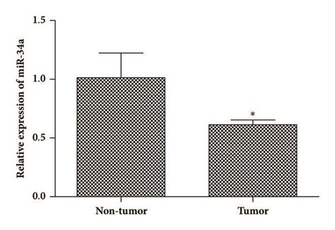 Decrease Of Mir 34a Expression Level In Hcc Rt Qpcr Was Applied To Download Scientific Diagram