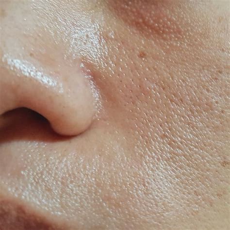 The Popular Skincare Ingredient That Can Cause Clogged 46 Off