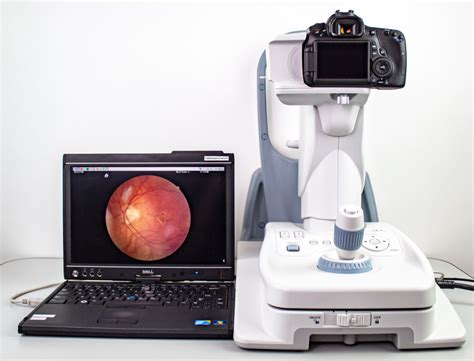Canon Cr 2 Digital Non Mydriatic Retinal Camera Jody Myers Eye Equipment