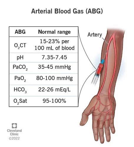 Sensacore Fully Automatic Abg Blood Gas Analyzer For Hospital Model