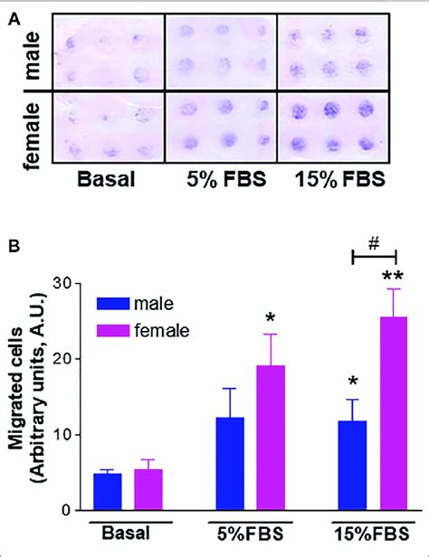 Effect Of Donors Sex On Huvec Migration In A Chemotaxis Assay Using