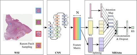 Mhattnsurv Multi Head Attention For Survival Prediction Using Whole Slide Pathology Images