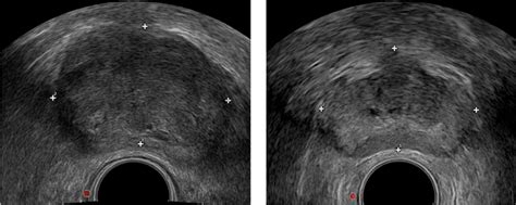 figure 1 from prostate ultrasound image segmentation based on dsu net