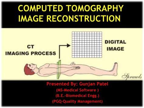 Ct Scan Image Reconstruction
