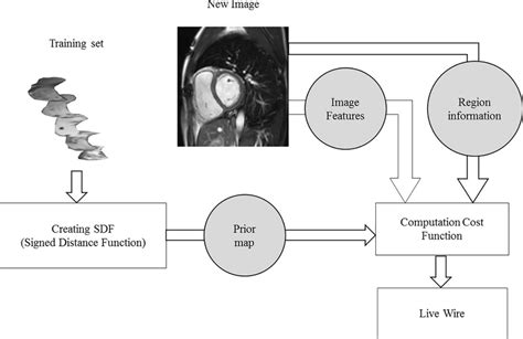 Overview Of Proposed Method For Right Ventricle Segmentation In Primary Download Scientific