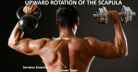 How To Reverse Kyphosis And The Dowagers Hump Using Corrective Exercises No Regrets Personal