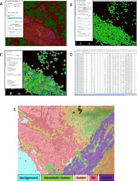 Quantitative Multispectral Analysis Following Fluorescent Tissue