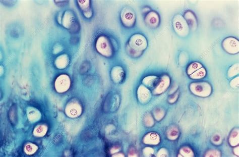 Hyaline Cartilage Light Micrograph Stock Image P1740036 Science