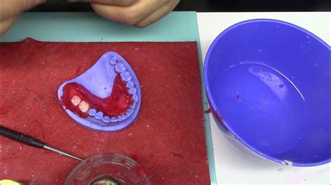 Setting And Wax Rim For Partial Denture دعبد القادر Youtube