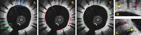 Demonstration Of Non Bright And Ambiguous Struts A Automated Strut Download Scientific