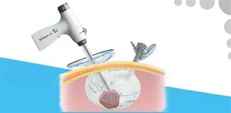 Safe Tissue Morcellation System At Best Price In Pune By Biorad Medisys