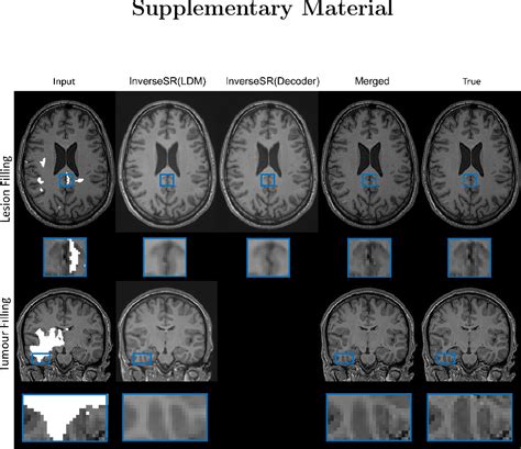 Inversesr 3d Brain Mri Super Resolution Using A Latent Diffusion Model