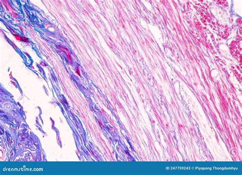 Small Intestine Duodenum And Vermiform Appendix Human Under The Microscope Stock Image Image