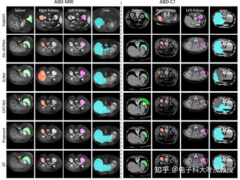 Medical Image Analysis 2024 高保真原型的小样本医学图像分割 知乎