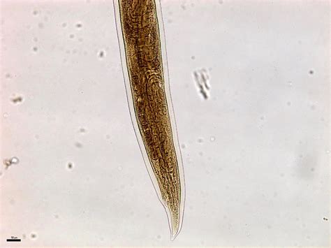 Ancylostoma Sp Roundworms Monster Hunters Guide To Veterinary