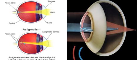 How To Correct Astigmatism Best Optometrist Dr Jeff Sciberras