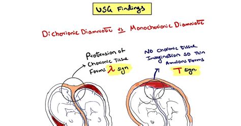Medicowesome Lambda Sign And T Sign