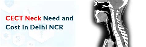 Cect Neck Need And Cost In Delhi Ncr Ganesh Diagnostic