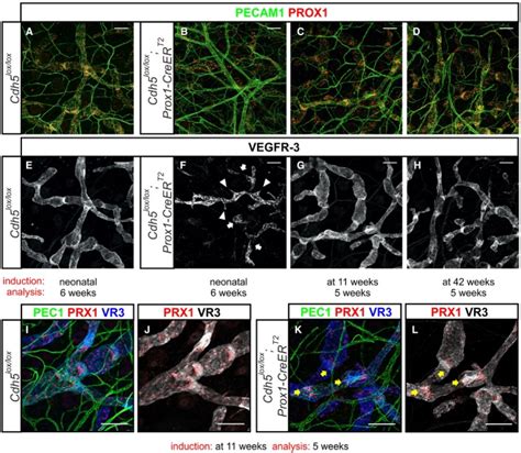 Distinct Roles Of Ve‐cadherin For Development And Maintenance Of Specific Lymph Vessel Beds Pmc