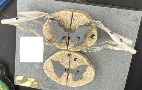Anatomy Lab Exam 3 Matching Spinal Cord Diagram Quizlet