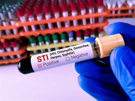 Testing For Sexually Transmitted Infections Herefordshire And