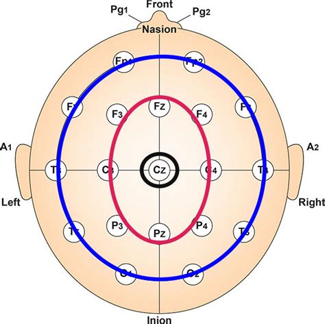 EEG Montages Part Pros And Cons
