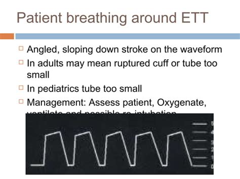 Etco2 In Non Intubated Patient A Must In Ed Ppt