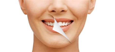 Smile Makeover What Are The Treatments And What Does It Cost