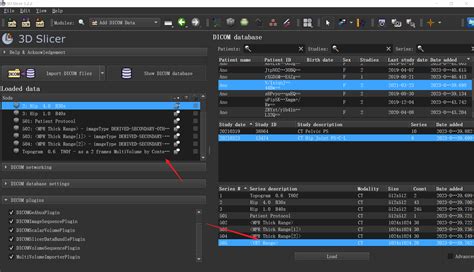 重建图像导入失败 问题求助 3dslicer中文论坛
